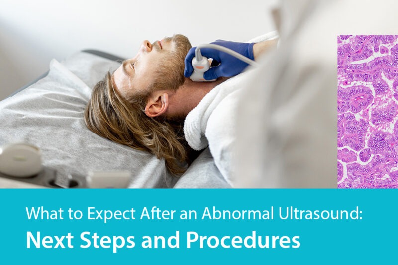 What to Expect After an Abnormal Ultrasound: Next Steps and Procedures