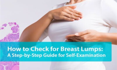 How to Check for Breast Lumps: A Step-by-Step Guide for Self ...