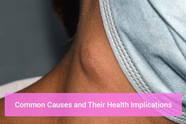 Understanding Lumps Nodules and Masses | Dr Nadelman