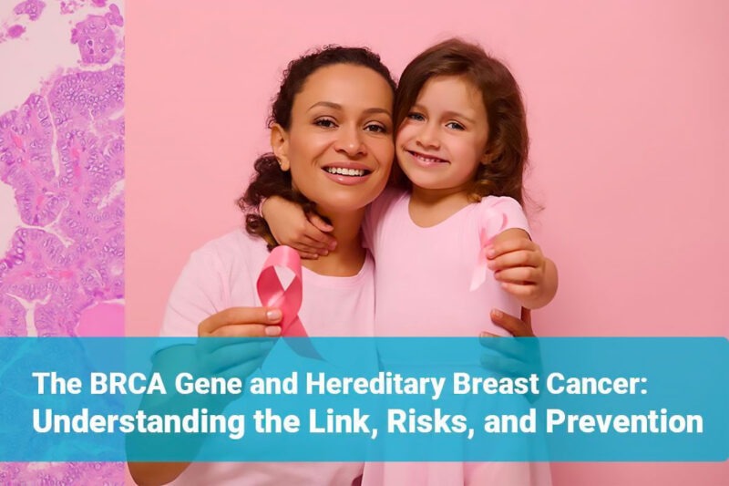 BRCA Gene and Hereditary Breast Cancer | Dr Nadelman
