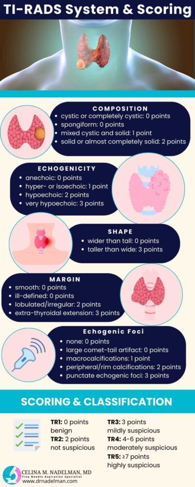 Understanding TIRADS & Thyroid Nodule Management Dr Nadelman