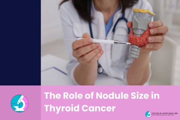 Understanding TIRADS & Thyroid Nodule Management Dr Nadelman