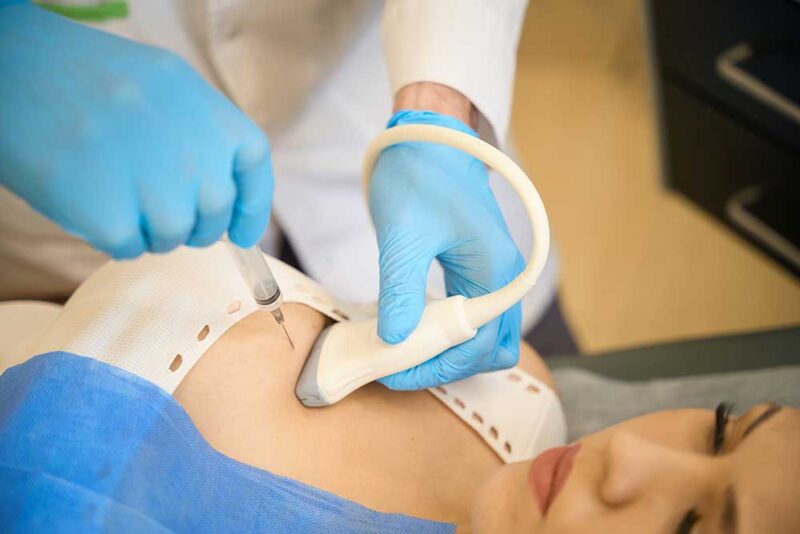 Fine Needle Aspiration (FNA) Guide by Dr. Celina Nadelman